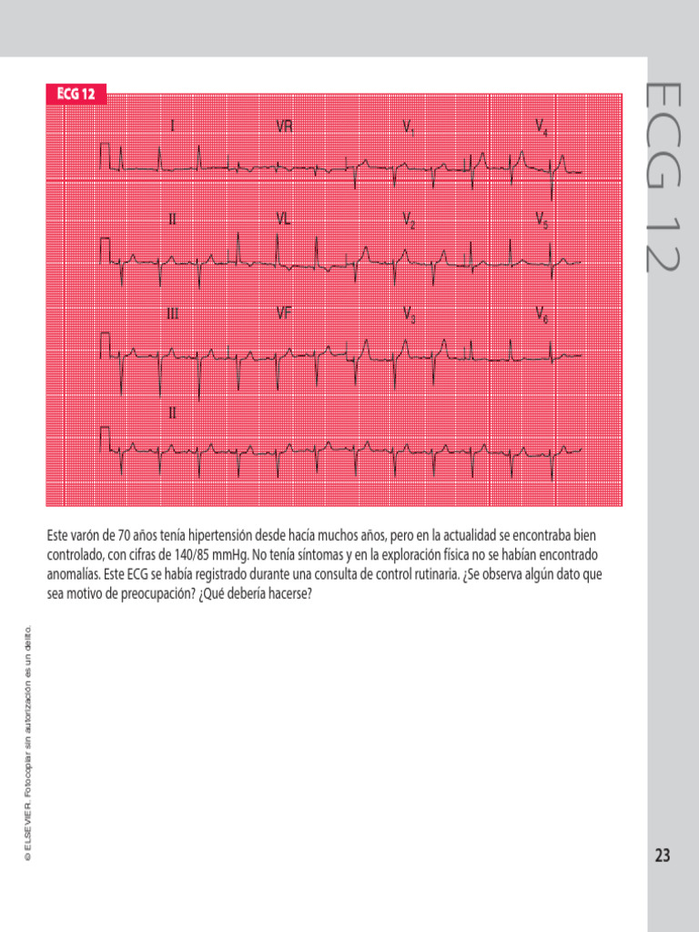 LIBRO DOC RAWDY 150 Problemas de ECG - Hampton 3ed | PDF