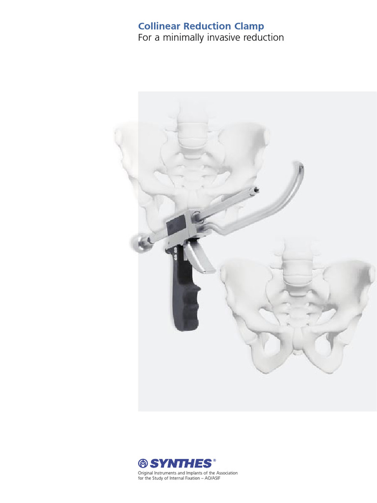 Collinear Reduction Clamp FL | PDF | Musculoskeletal System