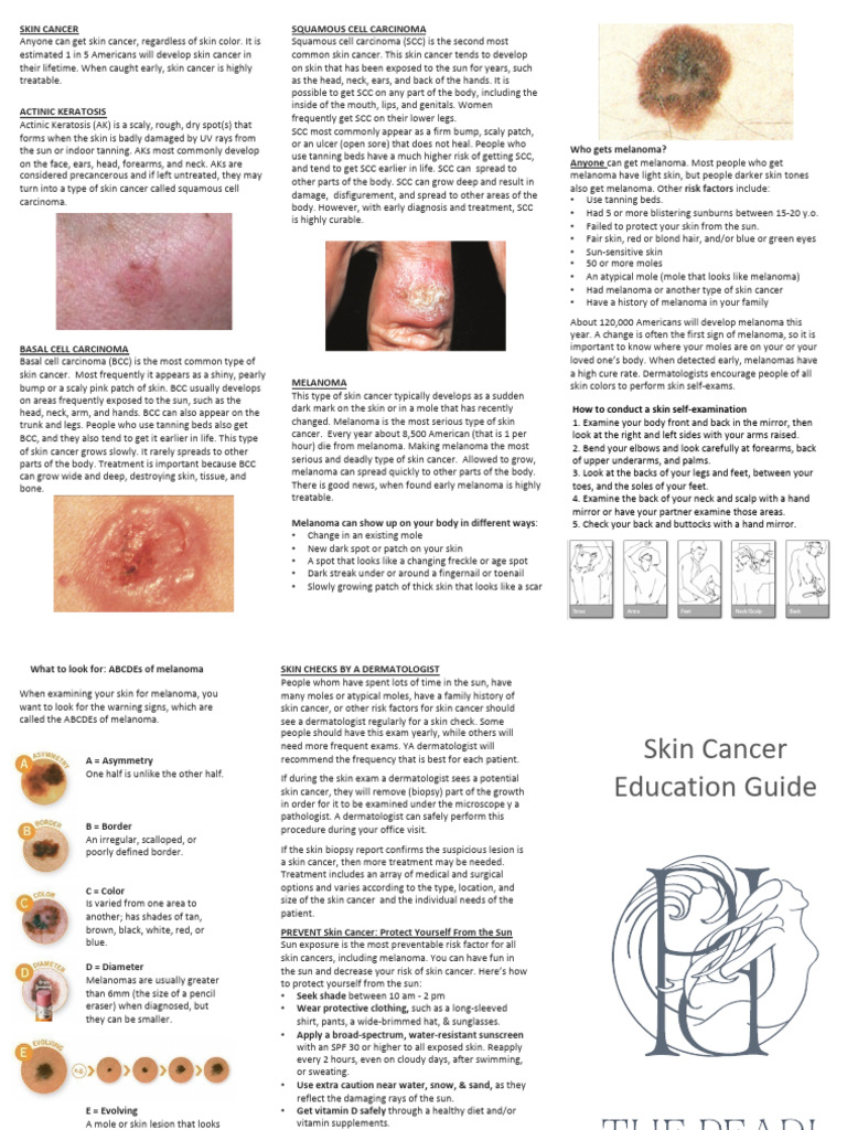Understanding Skin Cancer Types and Risks | PDF