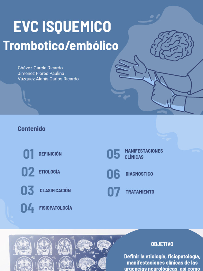 Evc Isquemico | PDF | Carrera | Isquemia