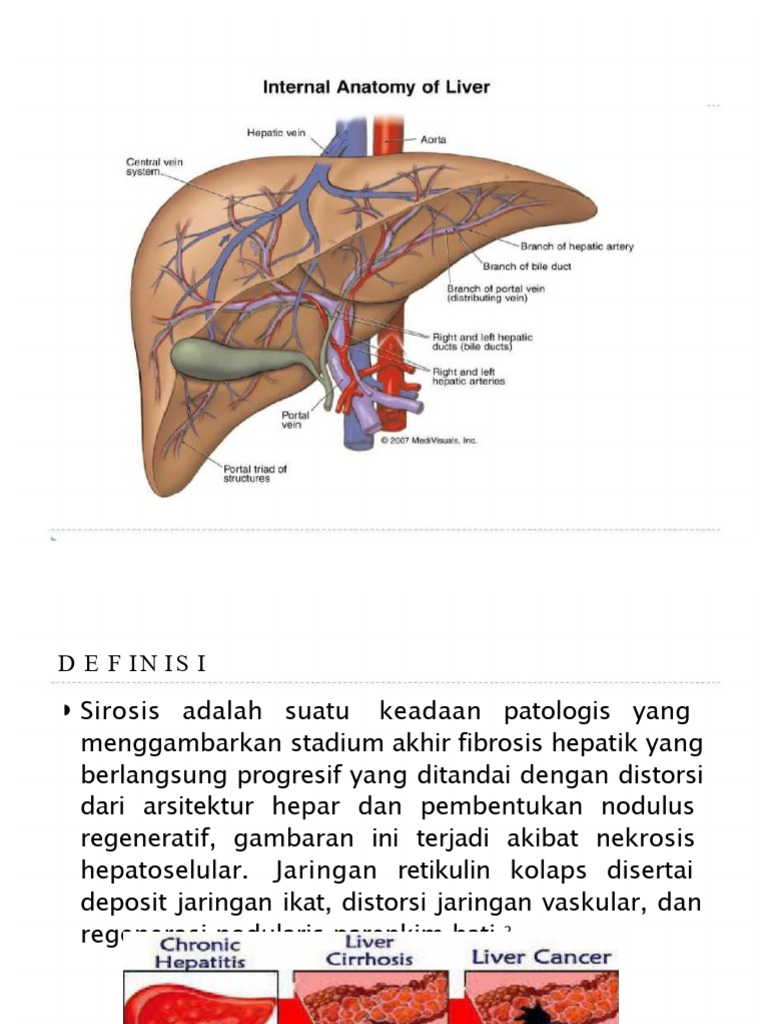 S Sirosis-Hati | PDF