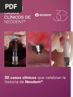 Easyguide Neodent | PDF | Implante dental | Cirugía