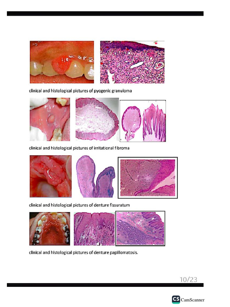 Oral Pathology | PDF