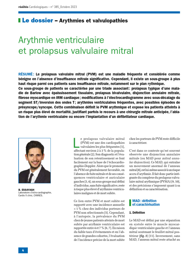 Prolapsus valvulaire mitral et arythmies | PDF | Arrêt cardiaque ...