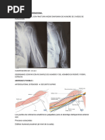 Técnica Quirúrgica Placa Philos: Conceptos | PDF | Tornillo | Metalurgia