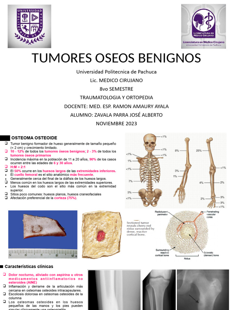 TUMORES OSEOS BENIGNOS 2 | PDF | Hueso | Especialidades Medicas