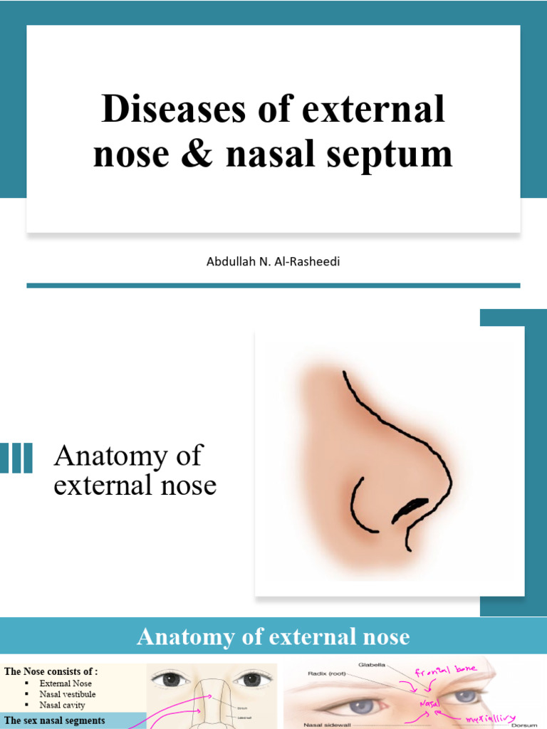 Diseases of external nose & nasal septum | PDF | Human Nose ...