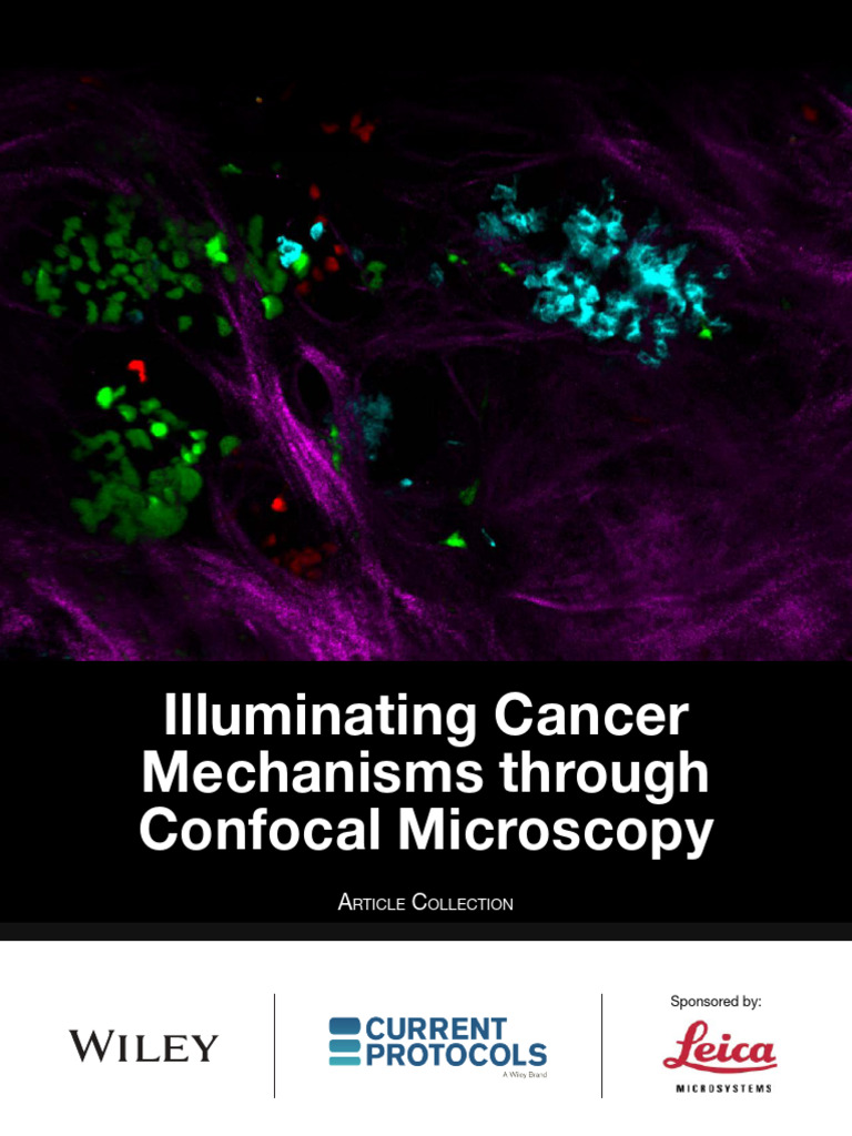 Article Collection Illuminating Cancer Mechanisms Through Confocal ...