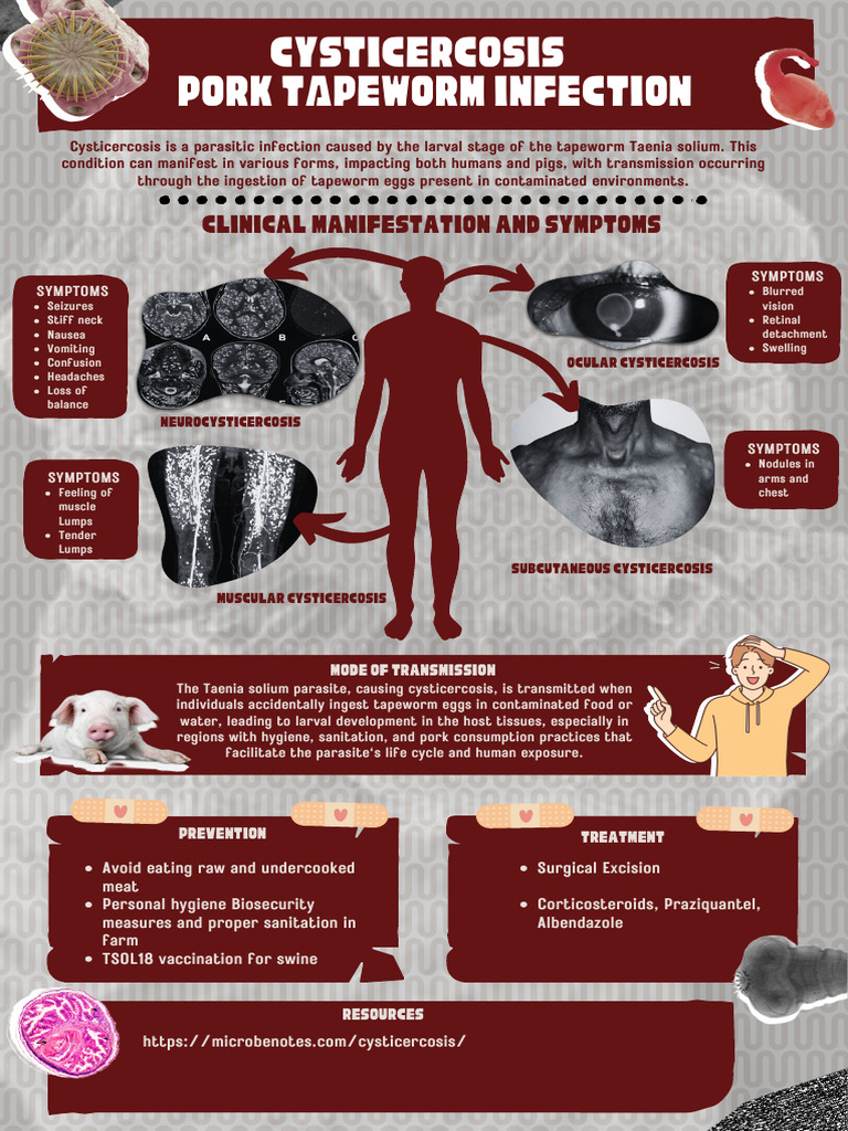 Clinical Manifestation and Symptoms: Cysticercosis Pork Tapeworm ...