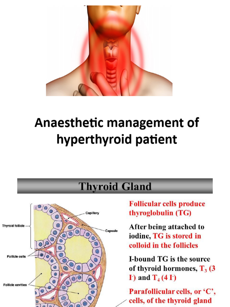 Anaesthetic Management of Hyperthyroid Patient | PDF