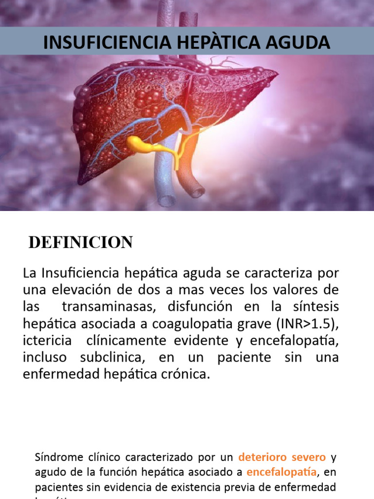 001 Insuficiencia Hepàtica Aguda | PDF