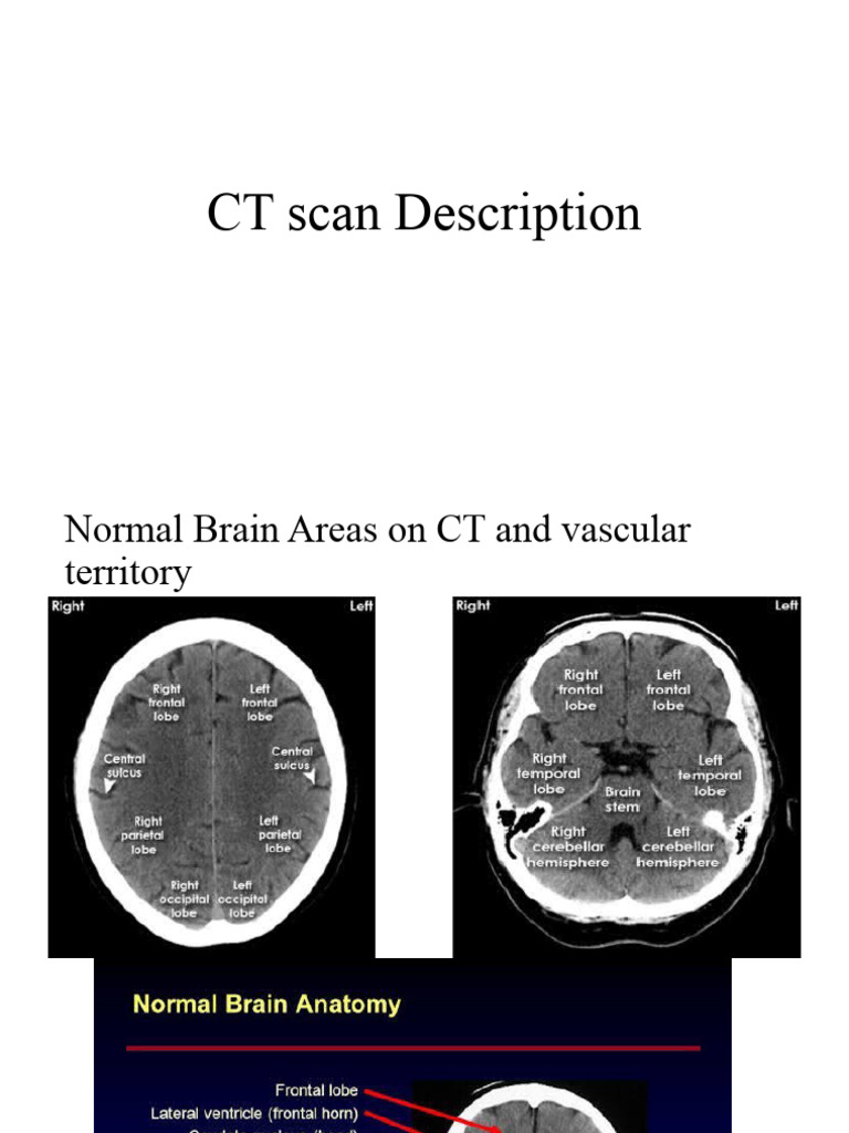 CT Scan final year | PDF