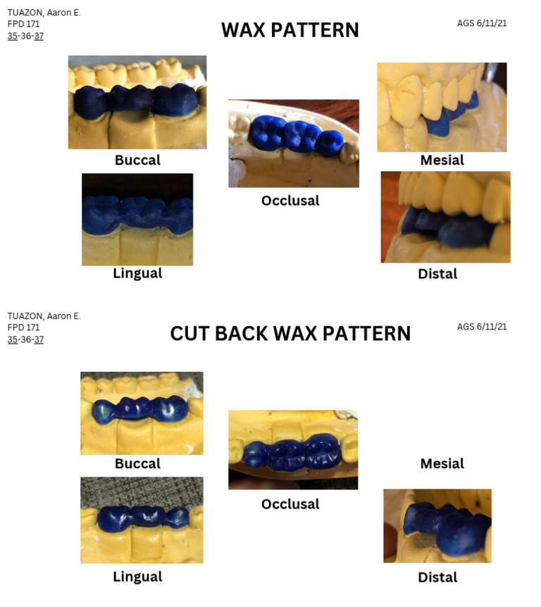 TUAZON-Wax Pattern | PDF