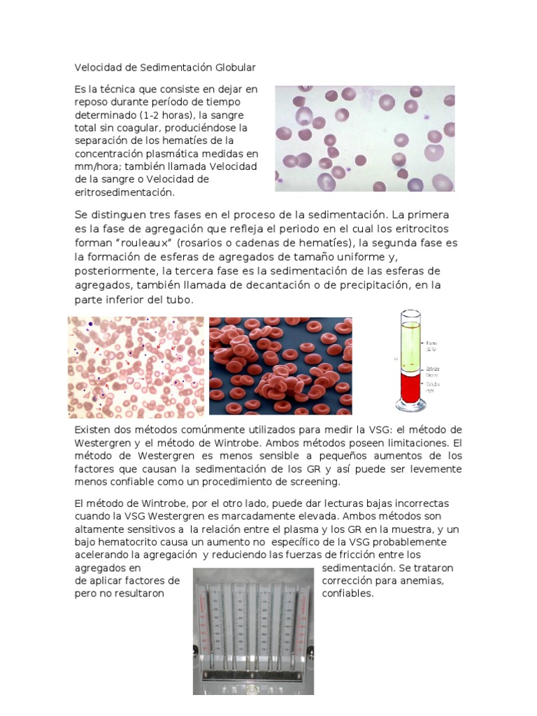 Velocidad De Sedimentación Globular Pdf Tejido Biología Hematología