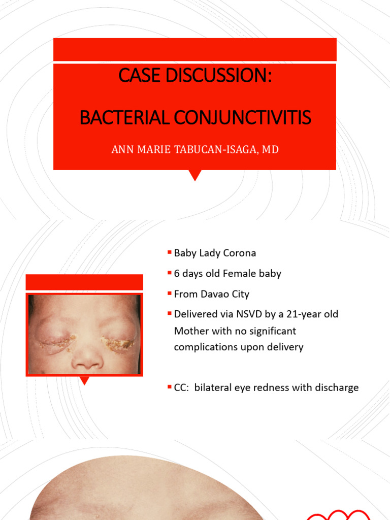 Case Bacterial Conjunctivitis | PDF