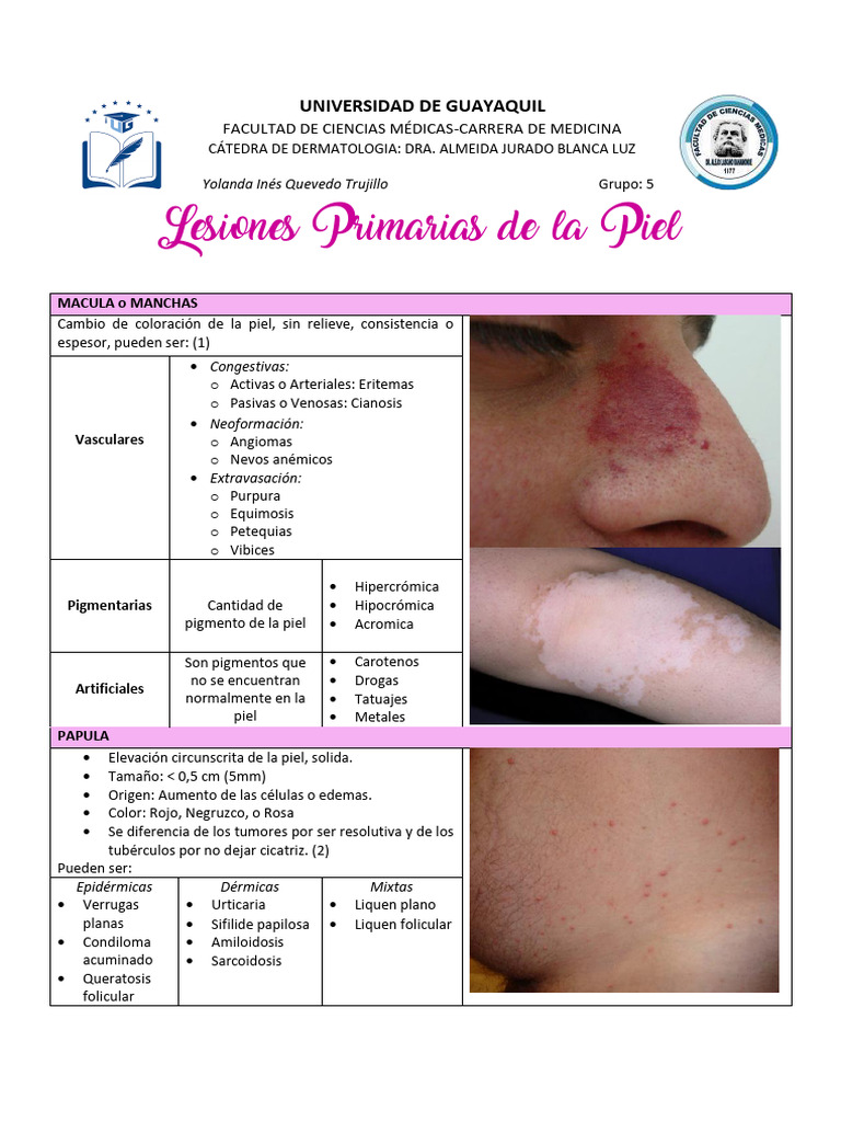 Lesiones Primarias de La Piel | PDF | Piel | Dermatología