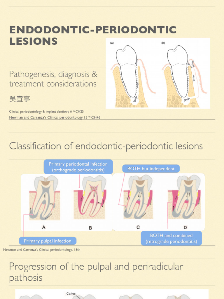 1114 Endo Perio | PDF