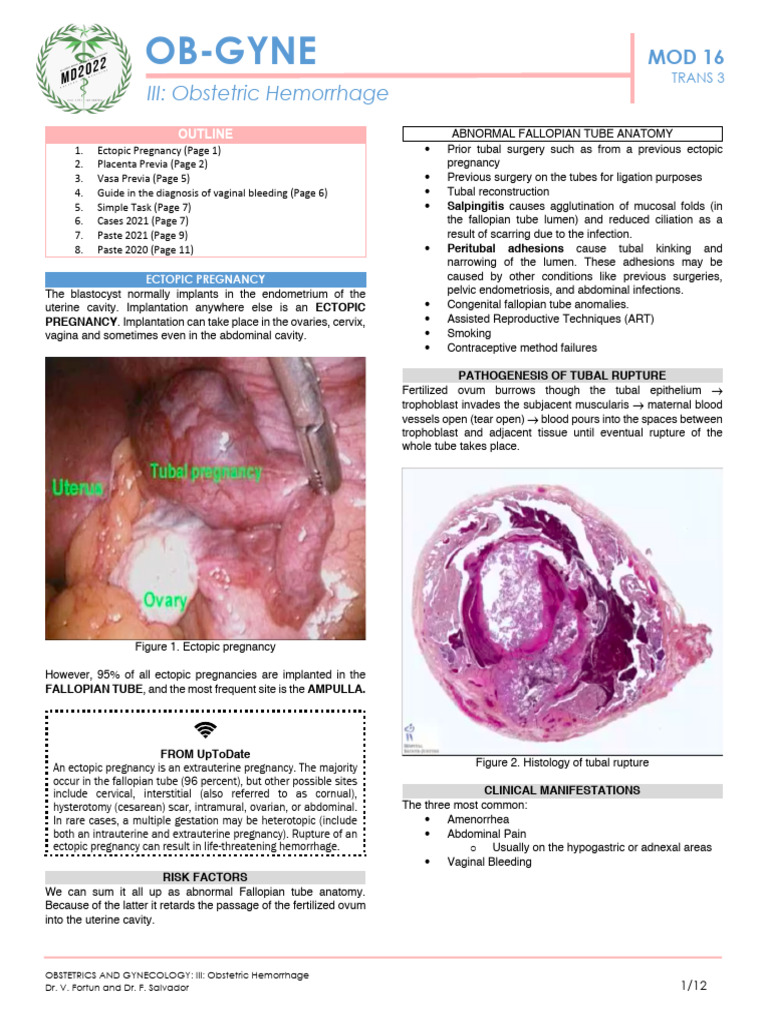 16.03 OBG Obstetric Hemorrhage | Download Free PDF | Childbirth | Pregnancy