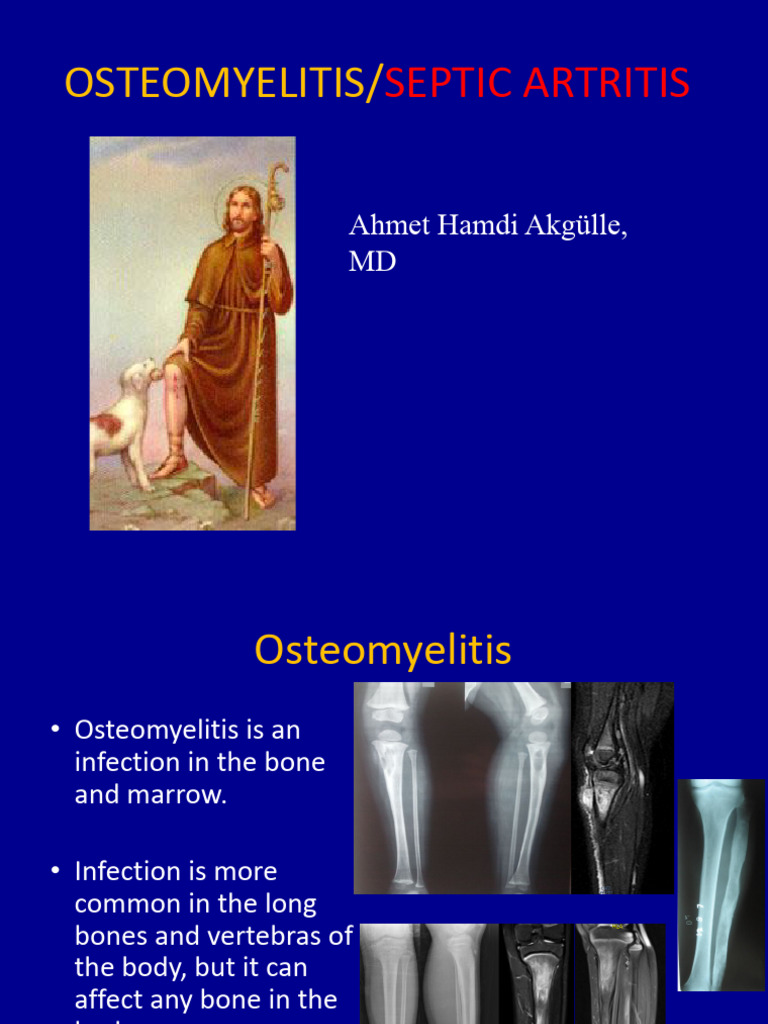 Orthopedic infections, Osteomyelitis:Septic Arthritis | PDF ...