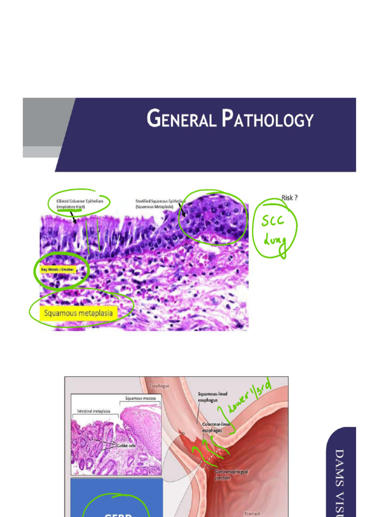 Pathology General DVT | PDF