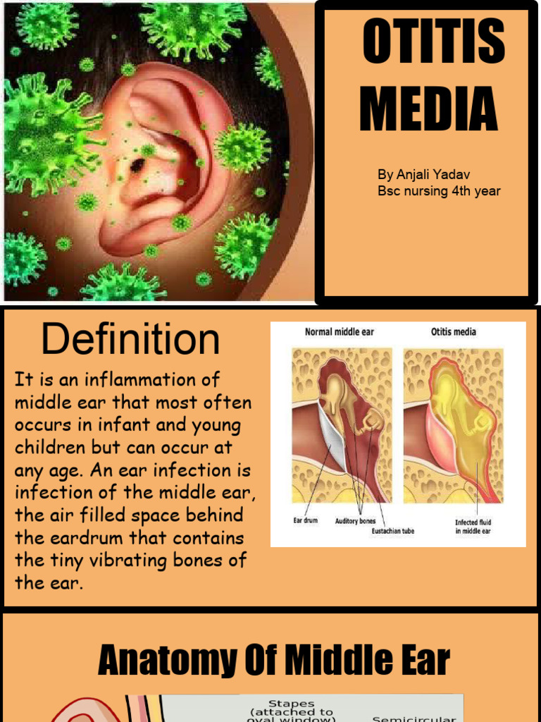 Otitis Media | PDF | Clinical Medicine | Medicine