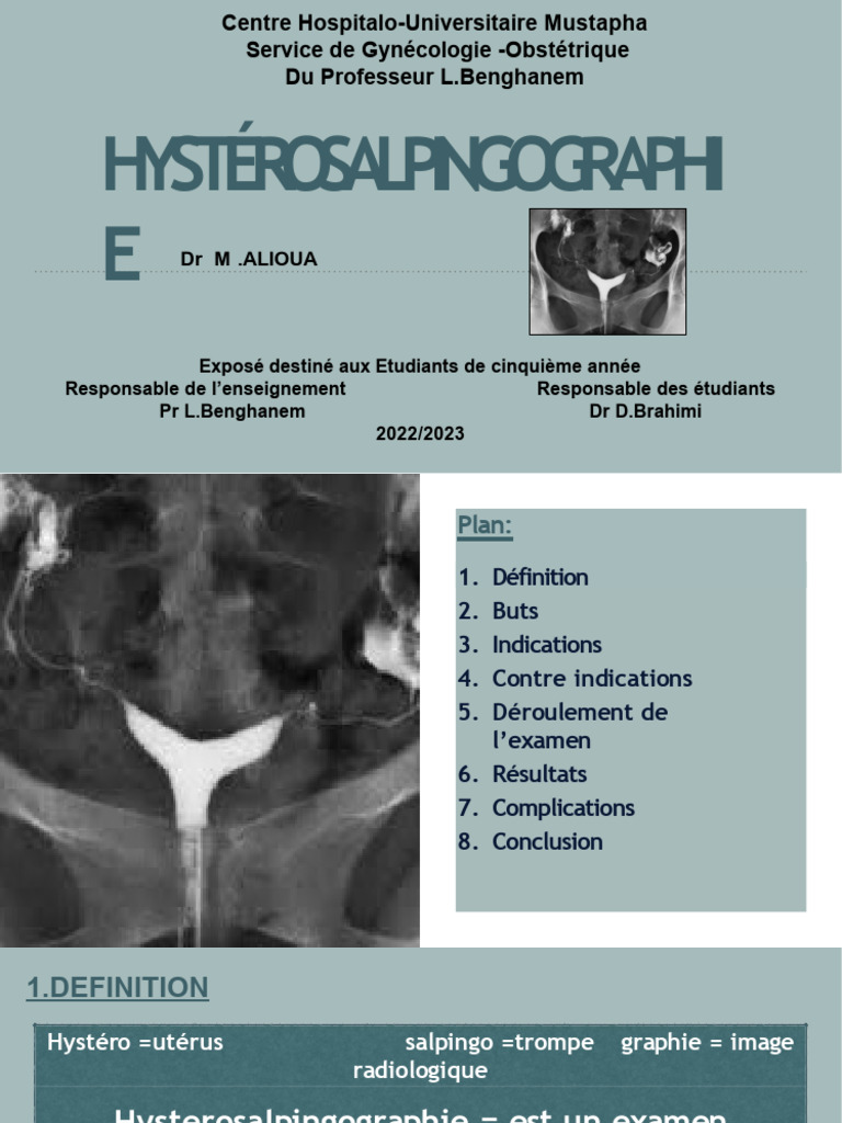 TD HSG PDF 21 | PDF | Utérus | Spécialités médicales