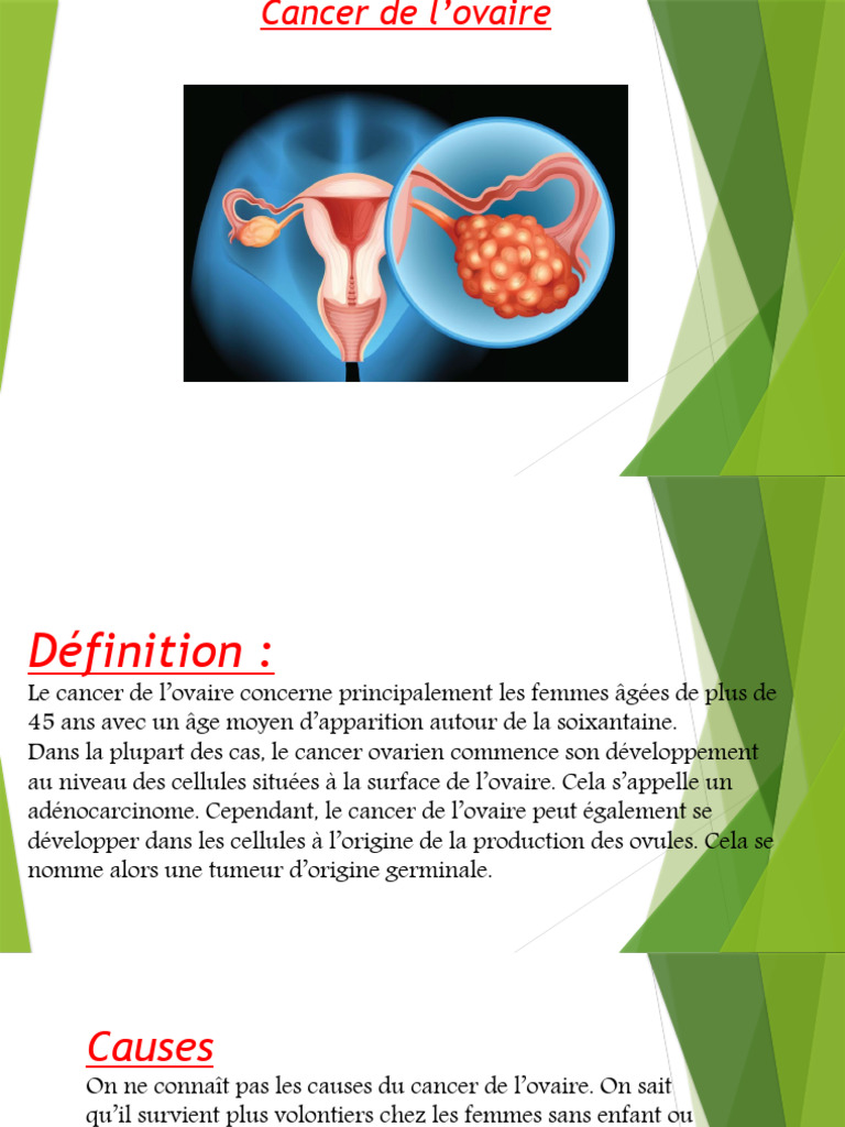 Cancer de L'ovaire | PDF | Cancer de l'ovaire | Cancer