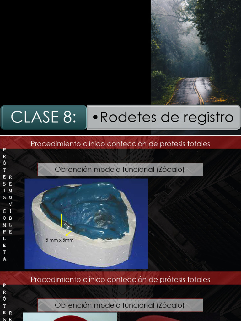 PTR Clases 8 y 9 Rodetes de Registro y Registro Maxilomandibular ...