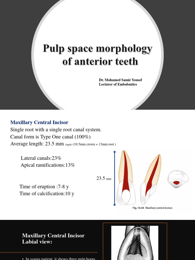 Pulp Space Morphology Anterior Teeth 2022 | PDF | Human Anatomy ...