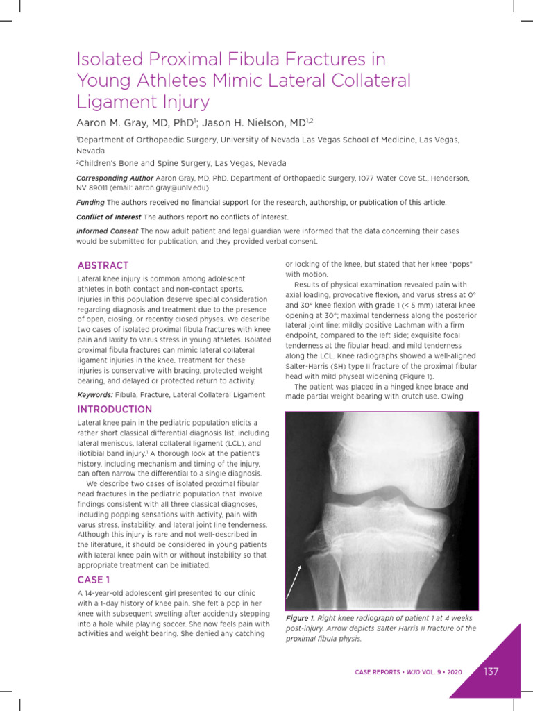 Isolated Proximal Fibula Fractures in Young Athletes Mimic Latera | PDF