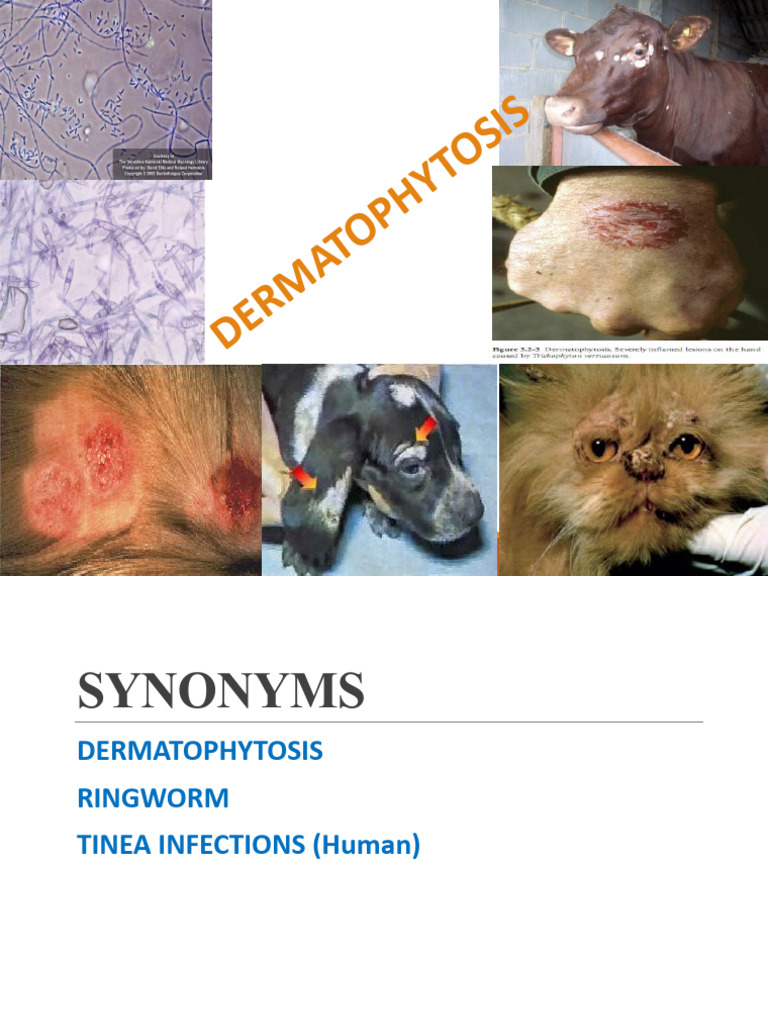 Ring Worm-Dermatomycosis | PDF | Mycology | Fungus