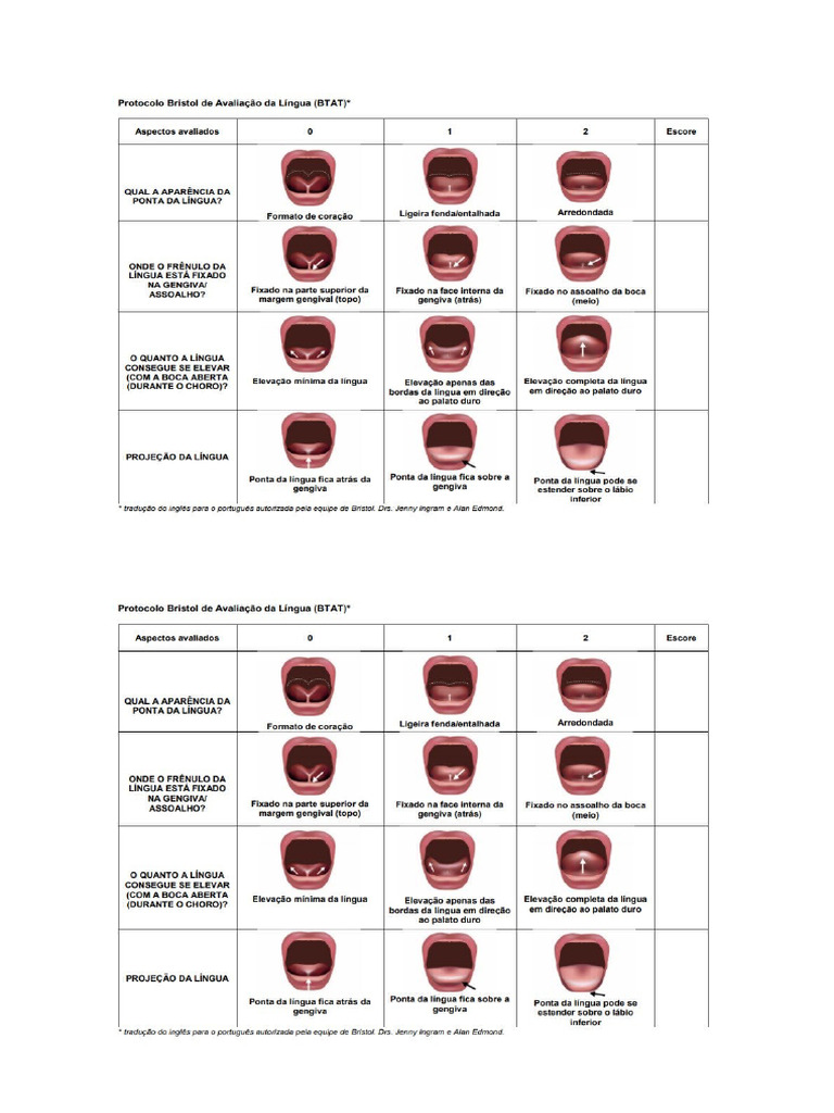 Protocolo de Teste Da Linguinha | PDF