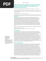 Delta Wave - LITFL Medical Blog - ECG Library Basics | PDF | Cardiac ...