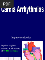 Atrial Fibrillation:Flutter in Pre-Excitation - LITFL - ECG Library ...