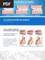 Clasificación Angle | PDF | Ortodoncia | Diente