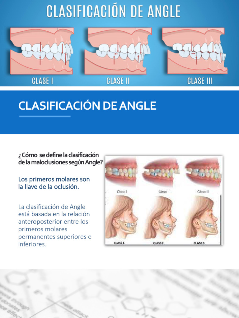 maloclusines de Angle anatomía 2023 | PDF