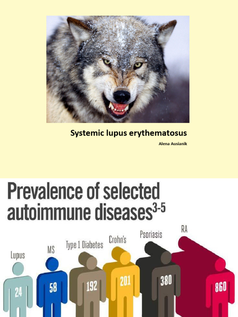 Systemic Lupus Erythematosus | PDF | Antibody | Human Leukocyte Antigen