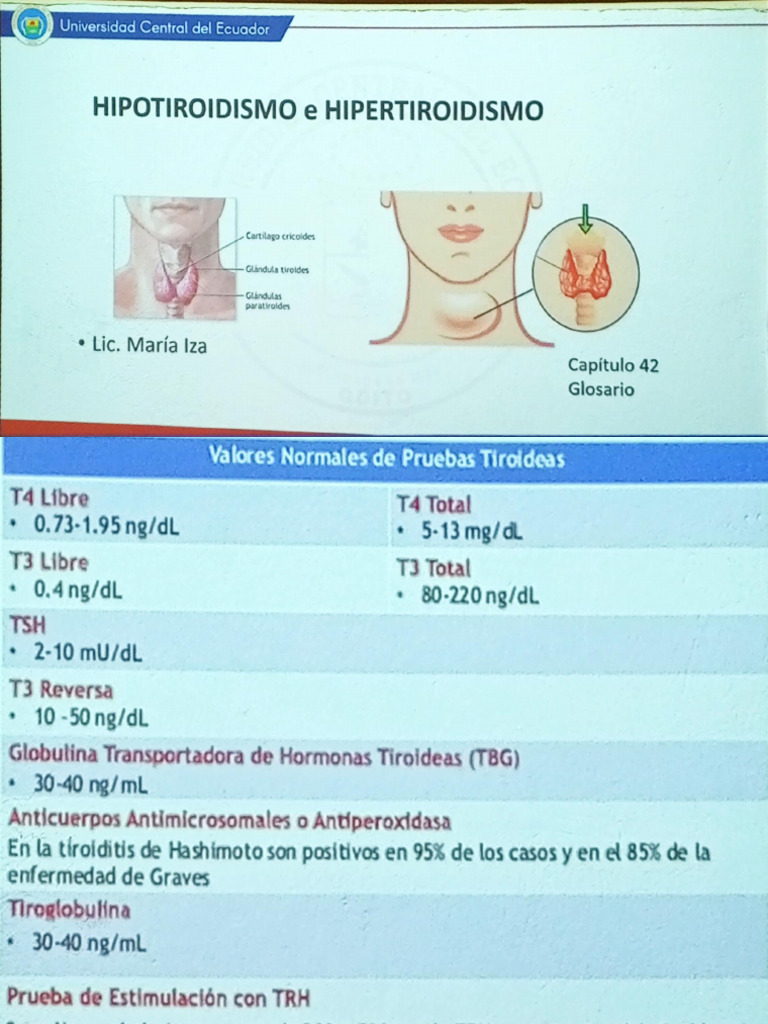 Hipotiroidismo | PDF