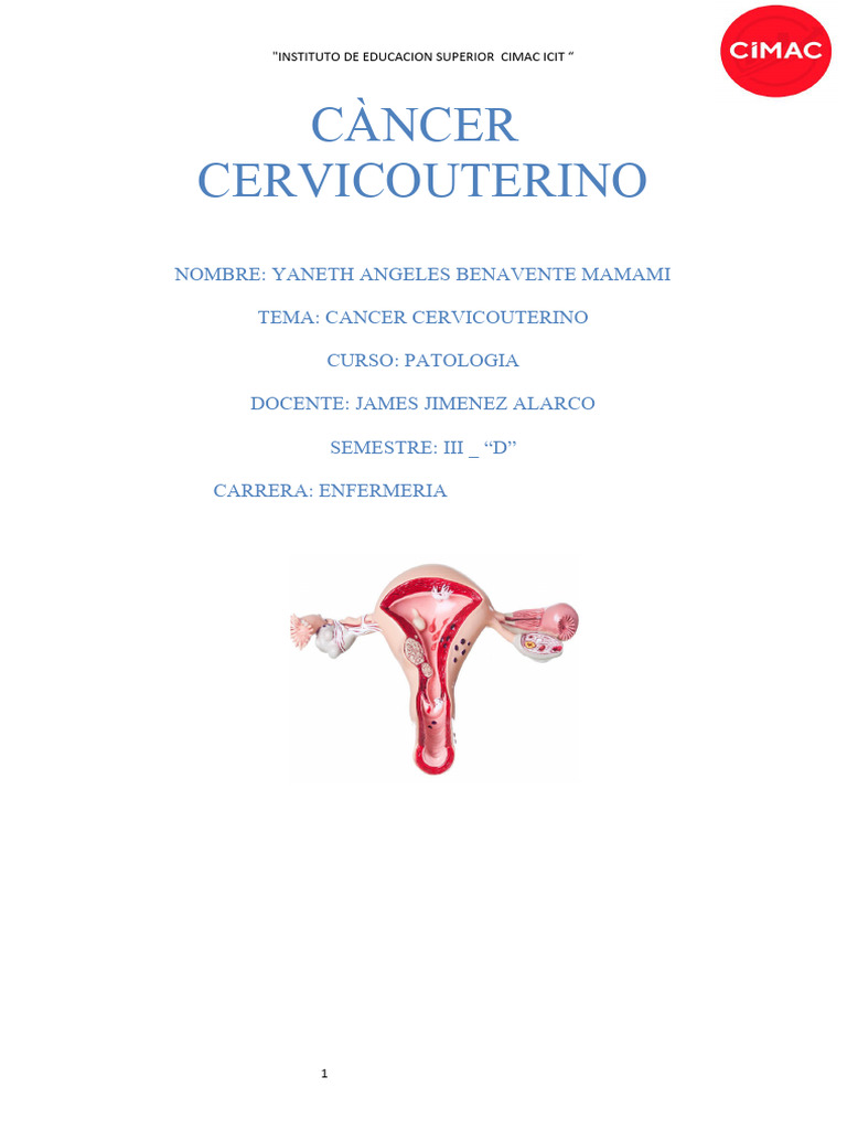 Càncer Cervicouterino | Descargar gratis PDF | Cáncer de cuello uterino | Cáncer