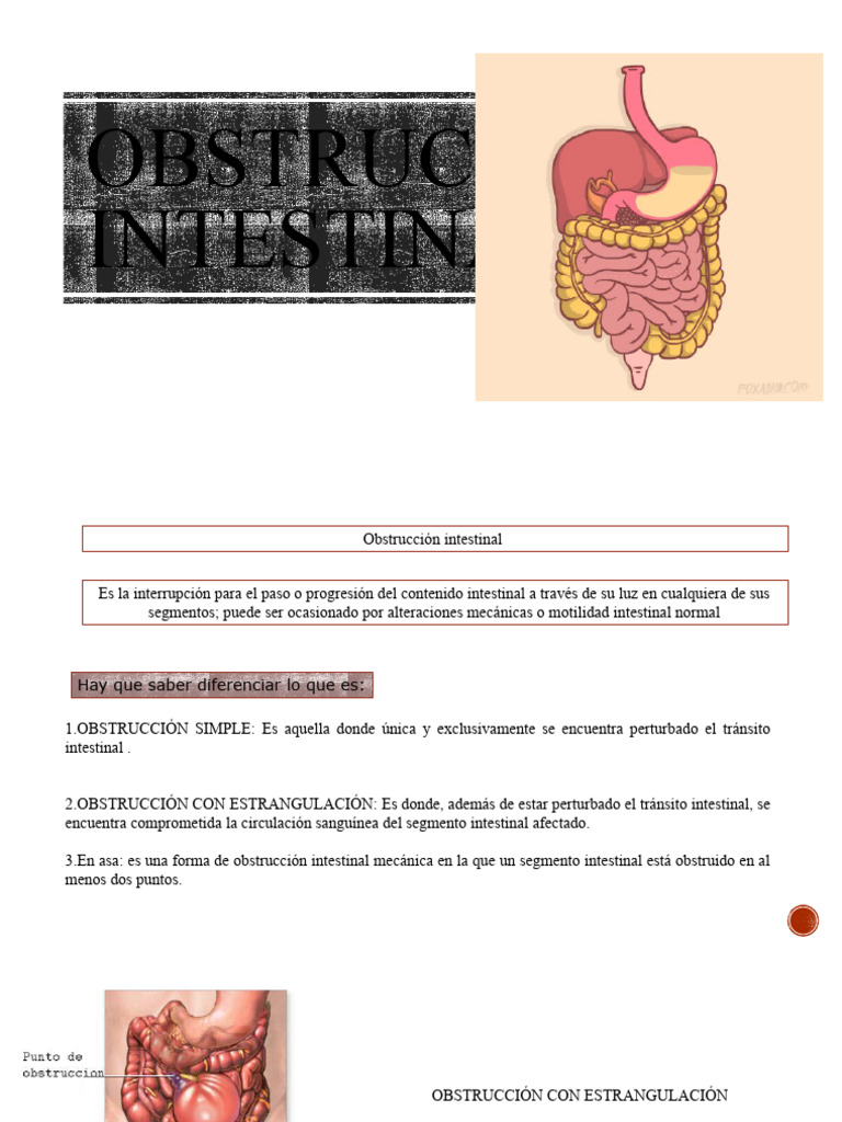 Tipos de Obstrucción Intestinal | PDF