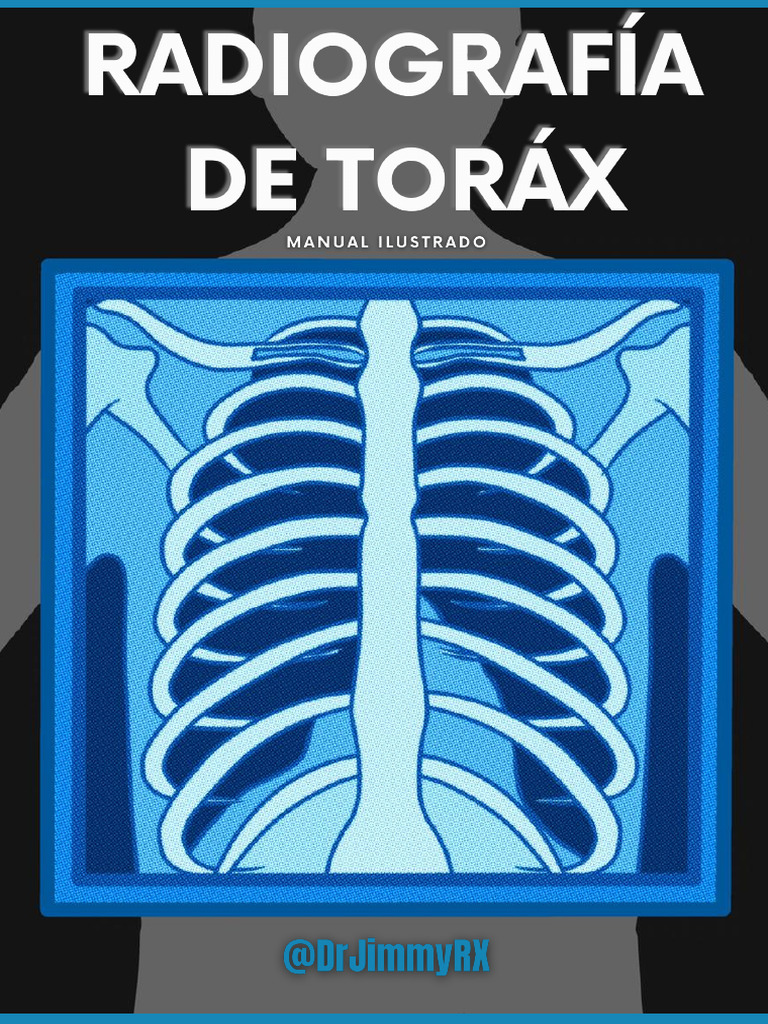 Guía de Interpretación de Rx de Tórax | PDF | Pulmón | Tórax (anatomía ...
