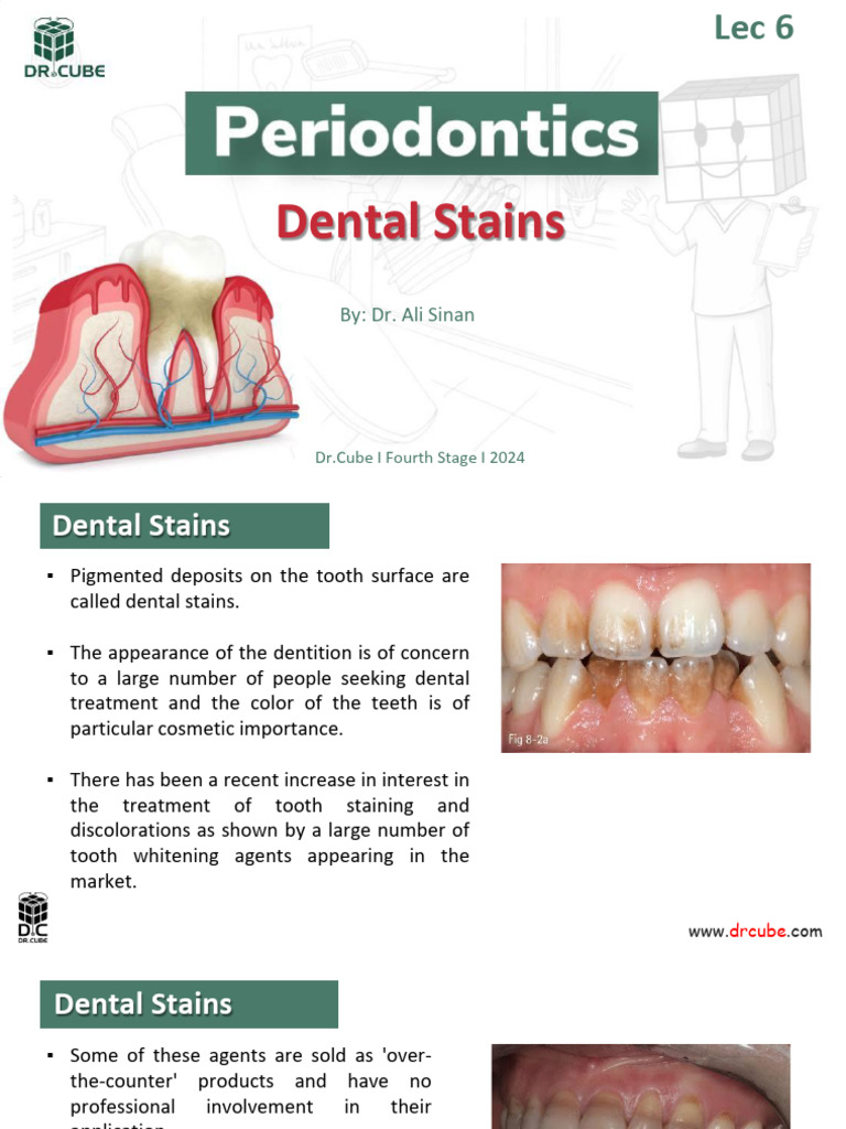 Perio Lec.6 Part 1 Dental Stains | PDF | Tooth Enamel | Medical Specialties