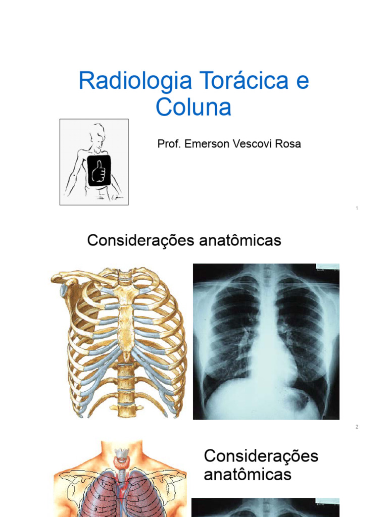 6 RX Tórax e Coluna | PDF | Coluna vertebral | Escoliose