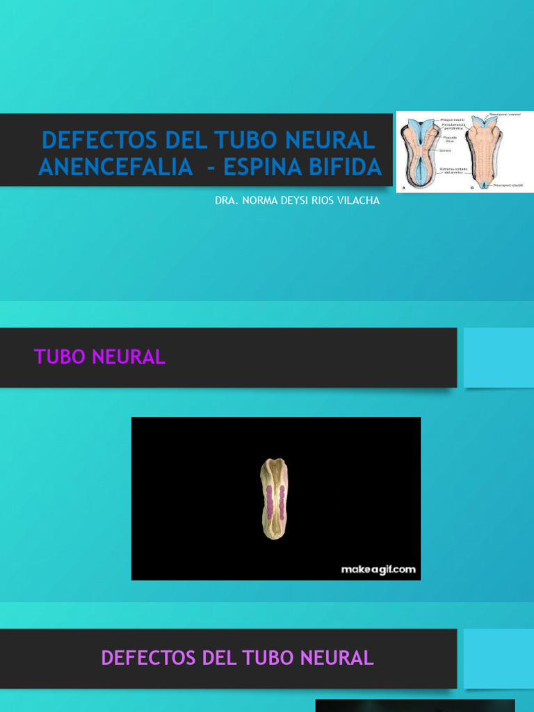 Defectos Del Tubo Neural Anencefalia - Espina Bifida | PDF ...