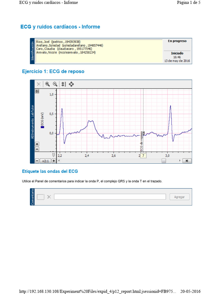 Cara Ecg | PDF | Electrocardiografia | Corazón