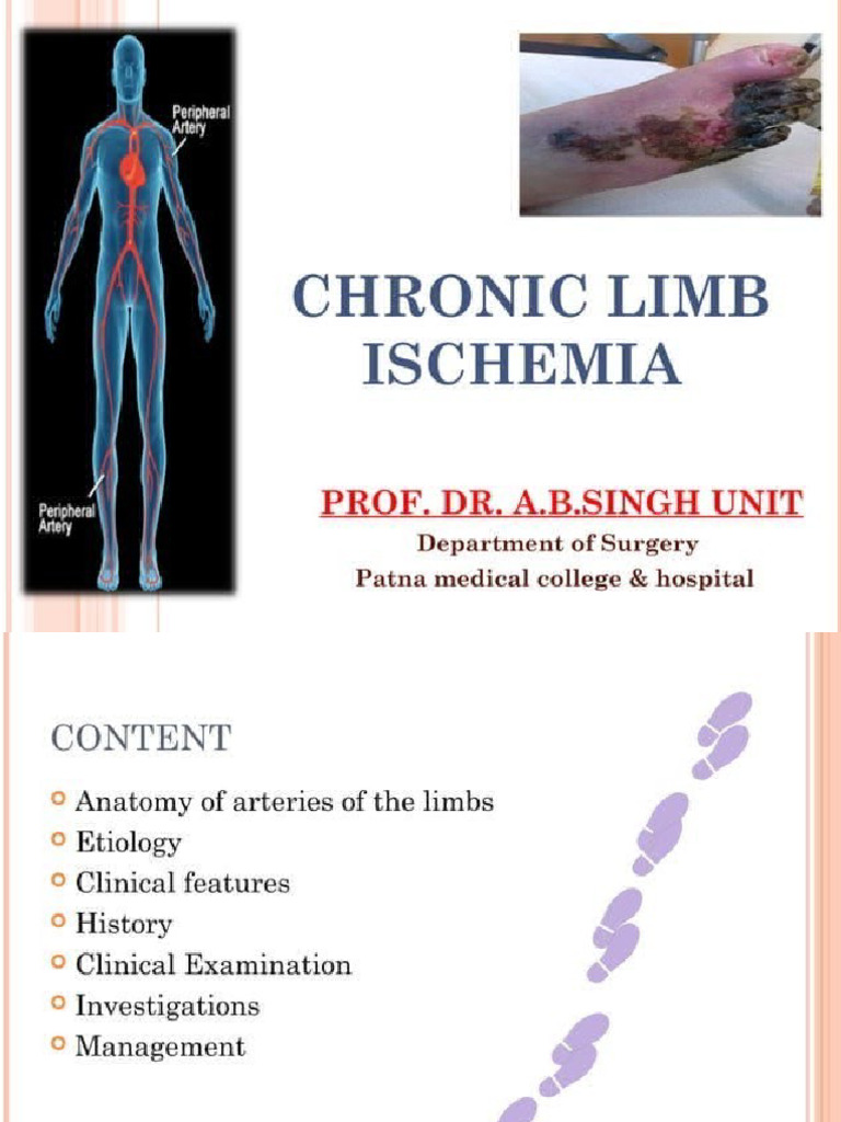 Chronic Limb Ischemic 2 | PDF