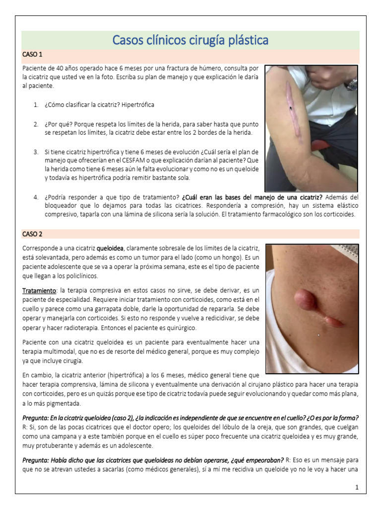 Casos Clínicos Cirugía Plástica | PDF
