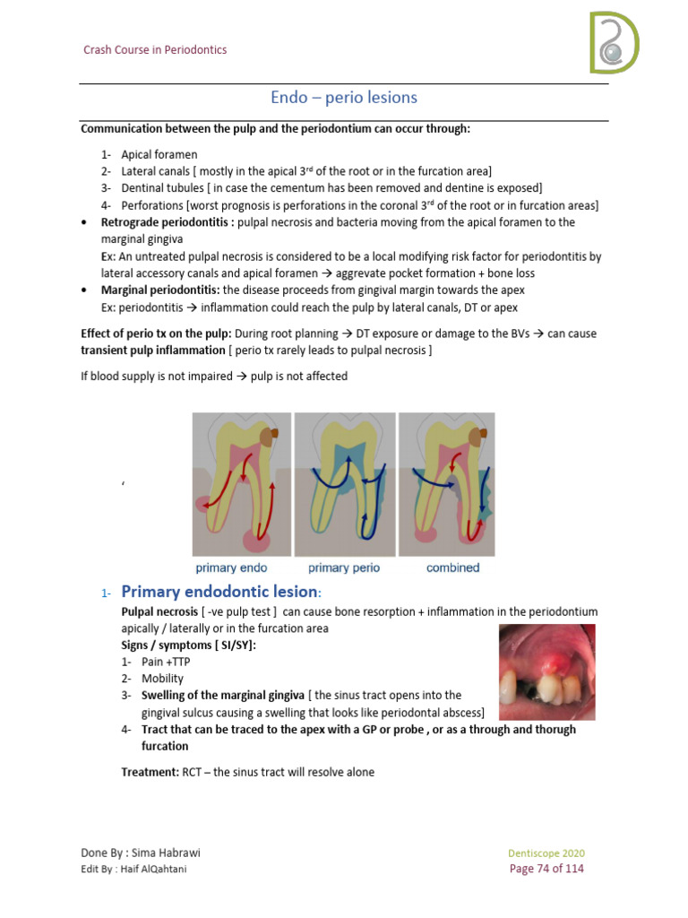 Endo Perio Lesions | Download Free PDF | Periodontology | Tooth