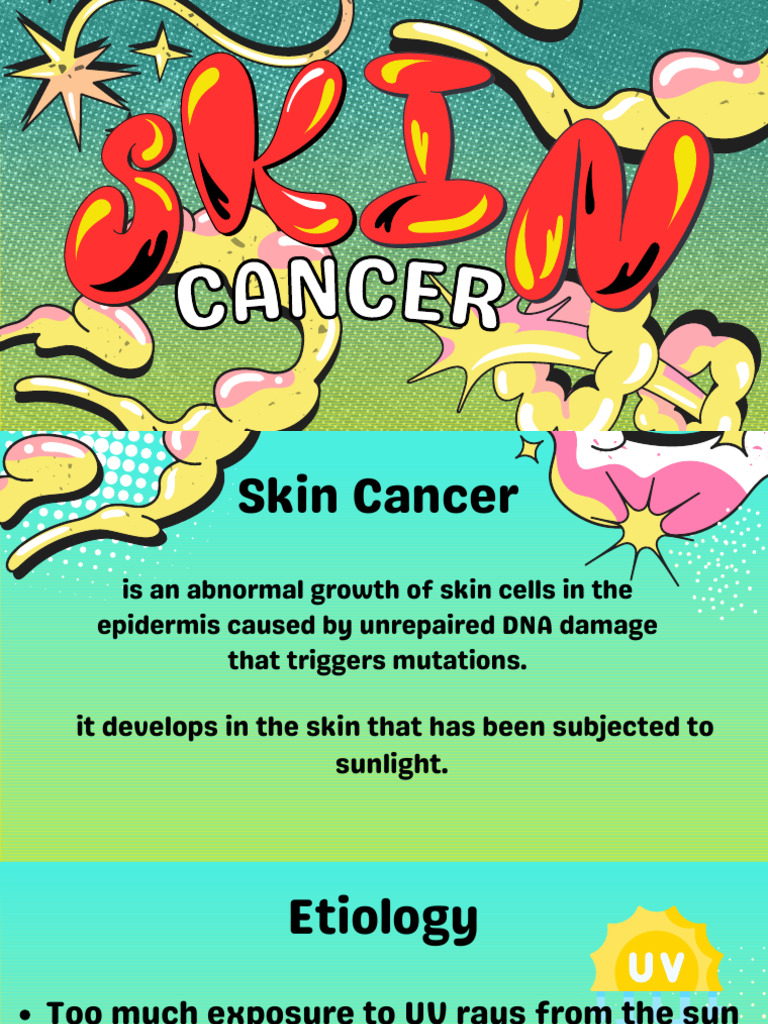 Skin Cancer | PDF | Melanoma | Skin Cancer