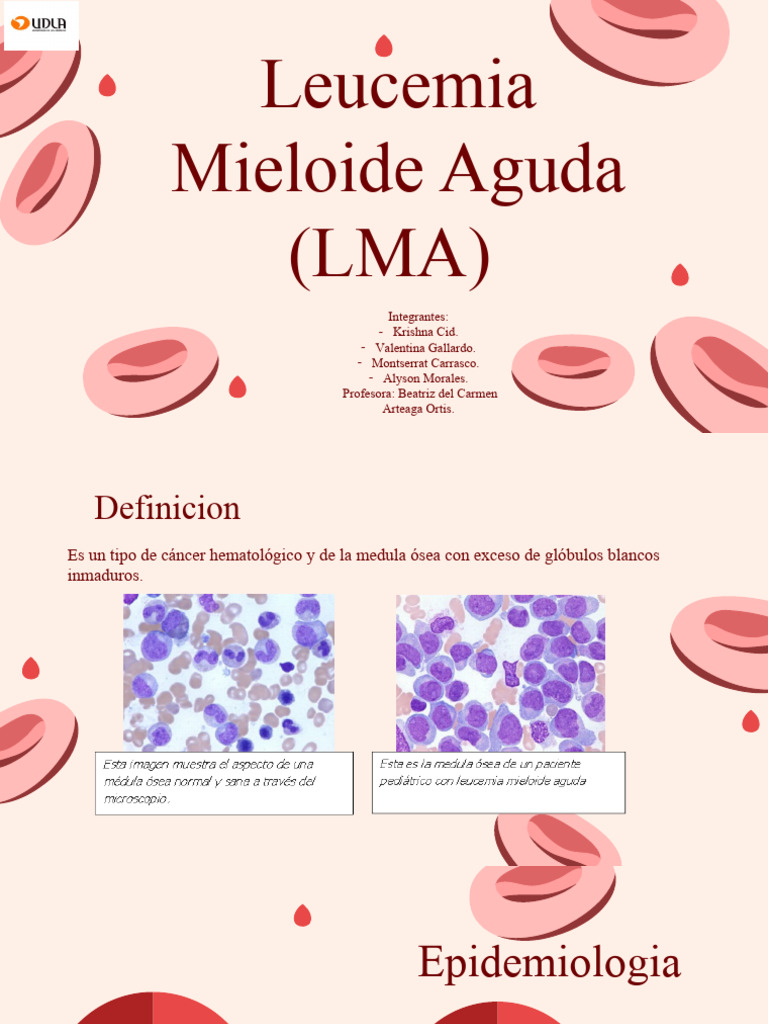 Leucemia | PDF | Leucemia | Cáncer